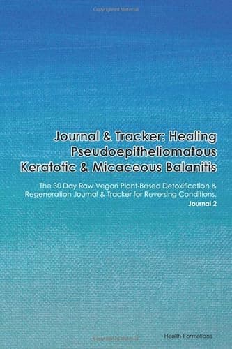 Our 10 Best How To Cure Balanitis for 2026 [US] | OneClearWinner.com